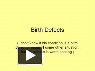 Birth Defects presentation | free to download