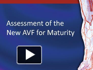 Assessment of the New AVF for Maturity presentation | free to download