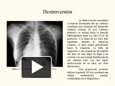 Dextroversi presentation | free to view
