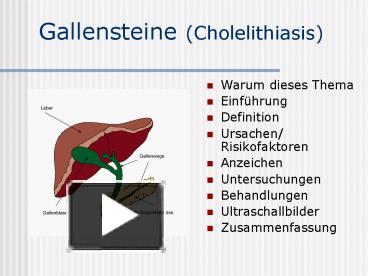 Gallensteine (Cholelithiasis) presentation | free to view