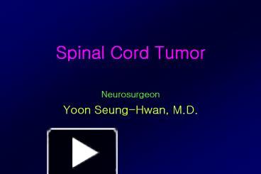 Spinal Cord Tumor presentation | free to view