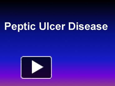 Peptic Ulcer Disease presentation | free to view