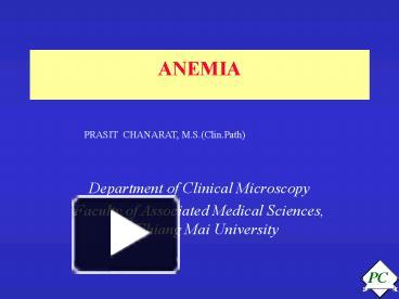 PPT – ANEMIA PowerPoint presentation | free to view - id: 5bccb-ZDc1Z