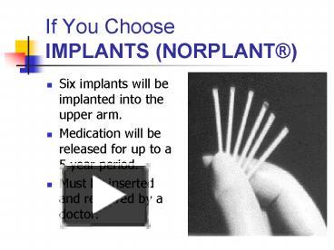 PPT – If You Choose IMPLANTS NORPLANT PowerPoint presentation | free to ...