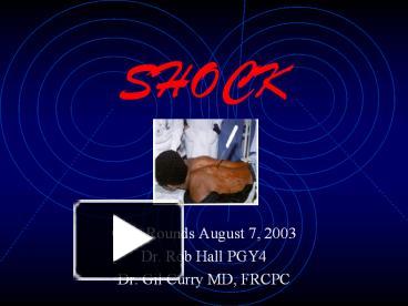 PPT – SHOCK PowerPoint presentation | free to download - id: 5d534b-MzMyM