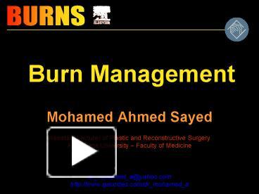 Burn Management presentation | free to view