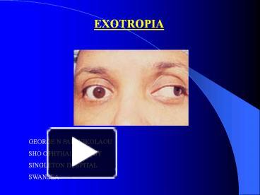 EXOTROPIA presentation | free to download
