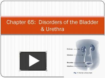 Chapter 65: Disorders of the Bladder presentation | free to view