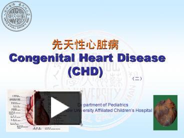 Congenital Heart Disease (CHD) presentation | free to view