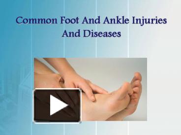 Common Foot and Ankle Injuries and Diseases presentation | free to download