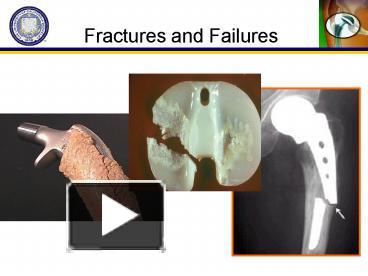Fractures and Failures presentation | free to view