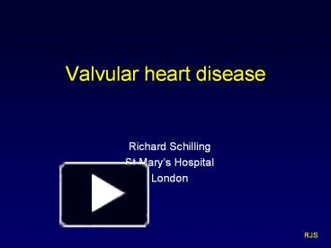 Valvular heart disease presentation | free to download
