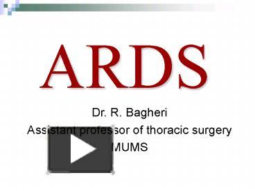 ARDS presentation | free to view
