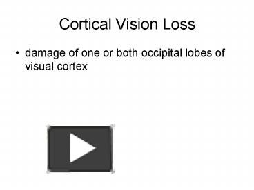 PPT – Cortical Vision Loss PowerPoint presentation | free to download ...