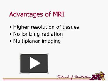 Advantages of MRI presentation | free to view
