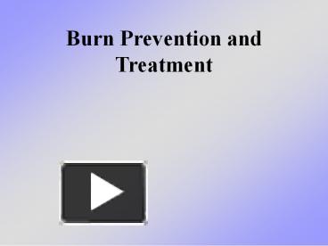 Burn Prevention and Treatment presentation | free to download