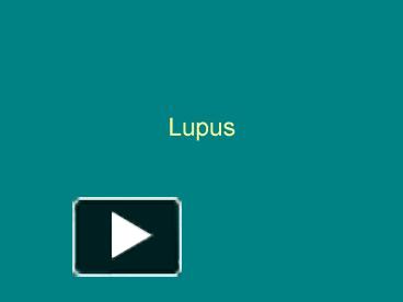 PPT – Lupus PowerPoint presentation | free to view - id: 620bc-ZDc1Z