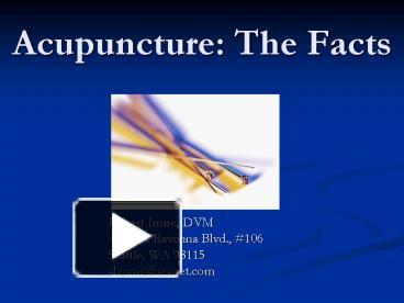 Acupuncture: The Facts presentation | free to view