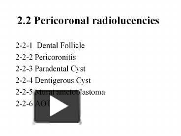 2.2 Pericoronal radiolucencies presentation | free to download