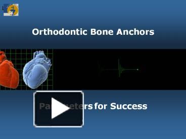 PPT – Orthodontic Bone Anchors PowerPoint presentation | free to ...