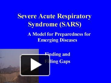 Severe Acute Respiratory Syndrome (SARS) presentation | free to view