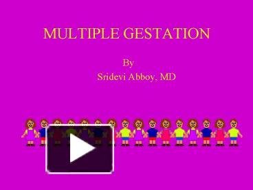 PPT – MULTIPLE GESTATION PowerPoint presentation | free to view - id ...