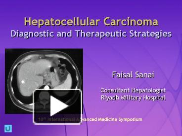 Hepatocellular Carcinoma Diagnostic and Therapeutic Strategies ...