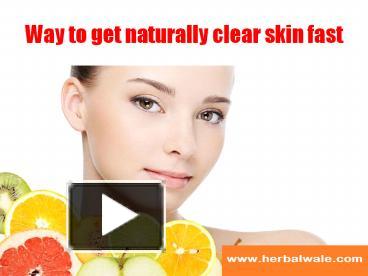 PPT – Way to get naturally clear skin fast PowerPoint presentation ...