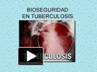 PPT – BIOSEGURIDAD EN TUBERCULOSIS PowerPoint presentation | free to ...