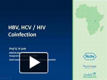 HBV, HCV HIV coinfection presentation | free to view