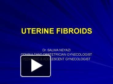 UTERINE FIBROIDS presentation | free to view
