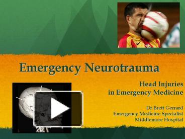 Emergency Neurotrauma presentation | free to view