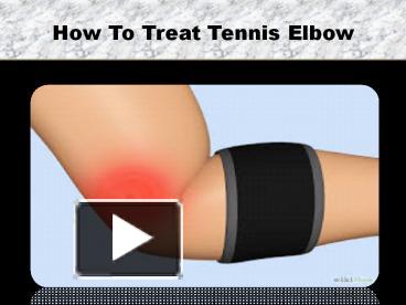 How To Treat Your Tennis Elbow (1) presentation | free to download