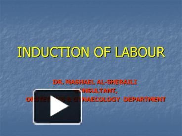 INDUCTION OF LABOUR presentation | free to view