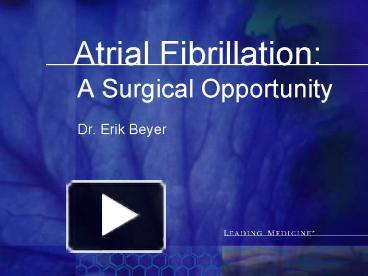 PPT – Atrial Fibrillation: PowerPoint presentation | free to view - id ...