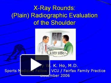 PPT – X-Ray Rounds: (Plain) Radiographic Evaluation of the Shoulder ...