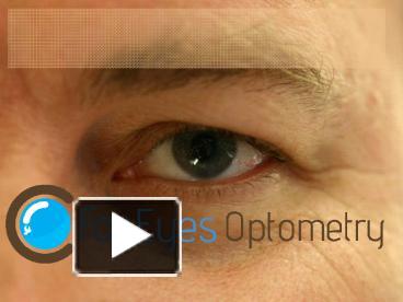 PPT – For Eyes Optometry PowerPoint presentation | free to download ...