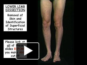 LOWER LIMB DISSECTION presentation | free to view