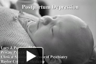 Postpartum Depression presentation | free to view