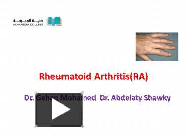 PPT – Rheumatoid Arthritis(RA) PowerPoint presentation | free to ...
