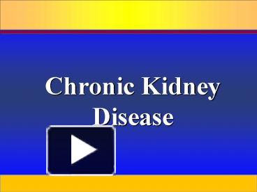 PPT – Chronic Kidney Disease PowerPoint presentation | free to view ...