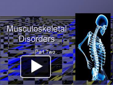 Musculoskeletal Disorders presentation | free to download