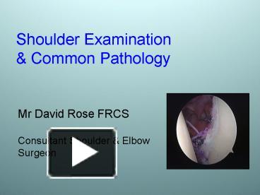 Shoulder Examination presentation | free to view