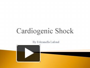 PPT – Cardiogenic Shock PowerPoint presentation | free to download - id ...