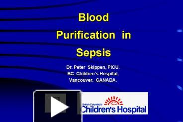 Blood Purification in Sepsis presentation | free to view
