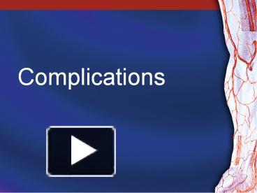 PPT – Complications PowerPoint presentation | free to view - id: 6f93-M2U1O