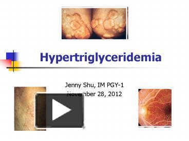 Hypertriglyceridemia presentation | free to view