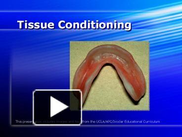 Tissue Conditioning presentation | free to view