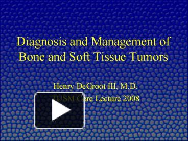 Diagnosis and Management of Bone and Soft Tissue Tumors presentation ...