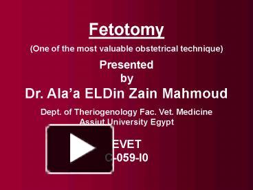 Fetotomy presentation | free to view